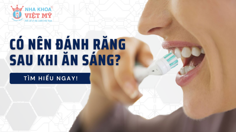 Lưu trữ Kiến thức - Nha Khoa Việt Mỹ