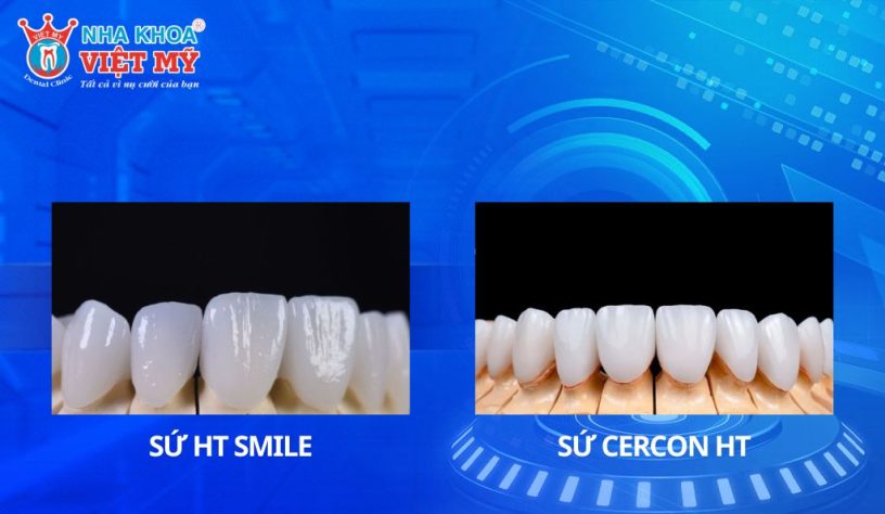 Răng sứ HT Smile có mấy loại và giá bao nhiêu tiền?